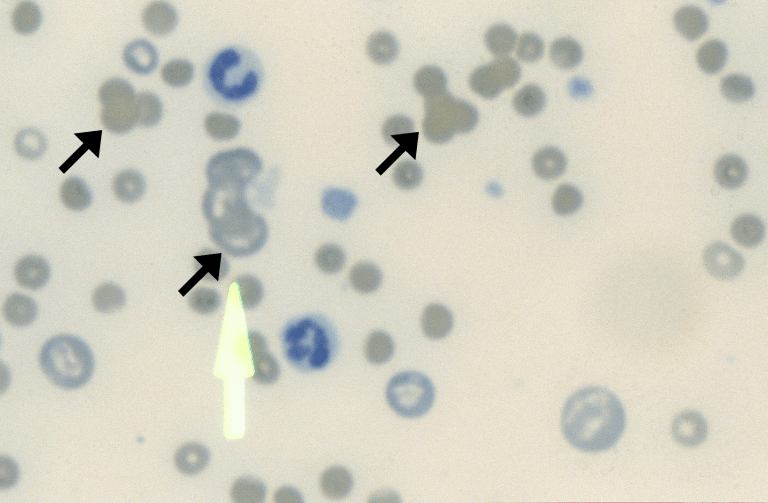 Agglutination – Cells and Smears