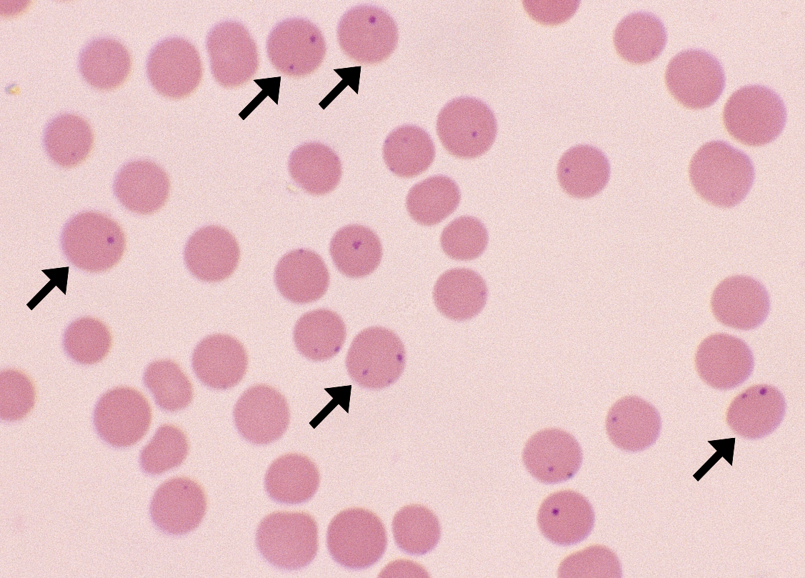 Anaplasma marginale – Cells and Smears