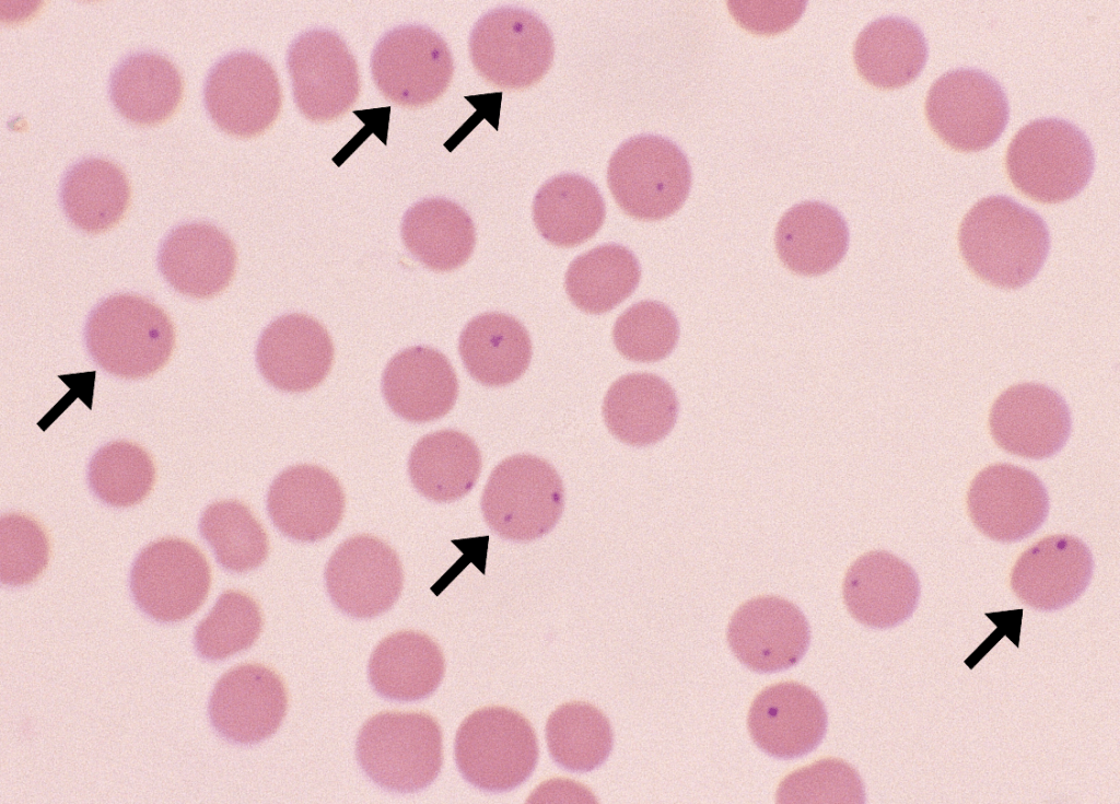 Anaplasma marginale – Cells and Smears