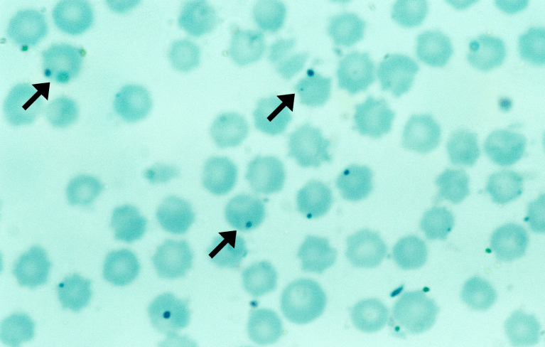 Anaplasma marginale – Cells and Smears