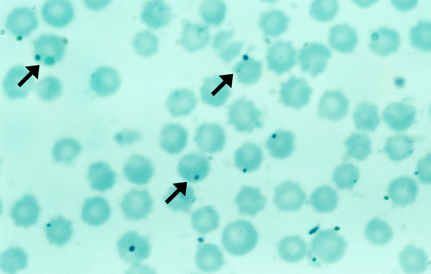 Anaplasma marginale – Cells and Smears