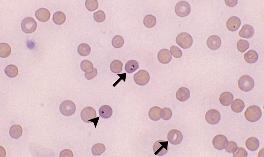 Babesia – Cells and Smears