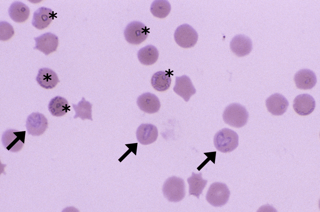 Babesia – Cells and Smears