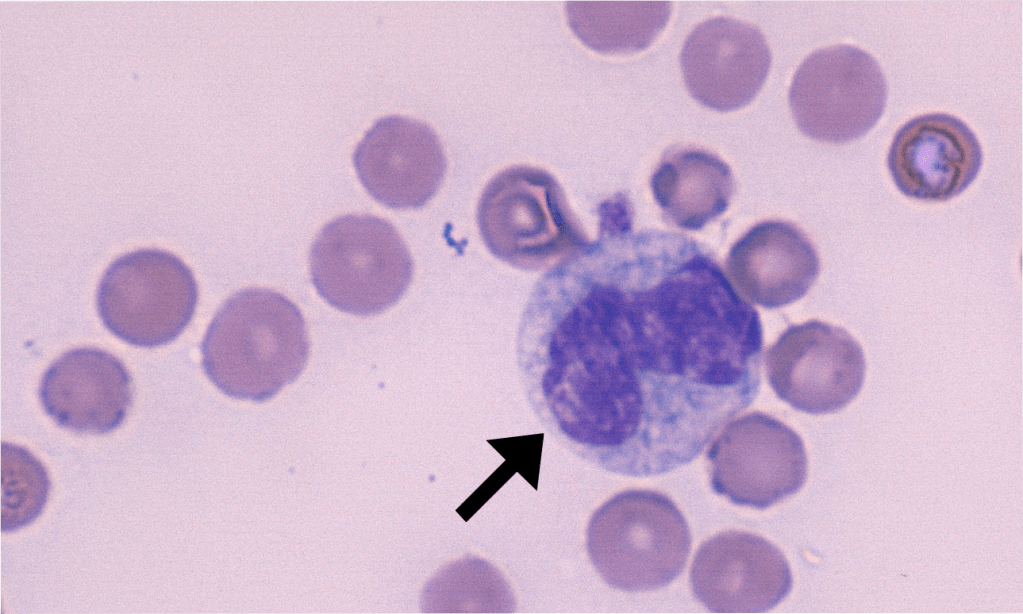Bands (Left Shift) – Cells and Smears