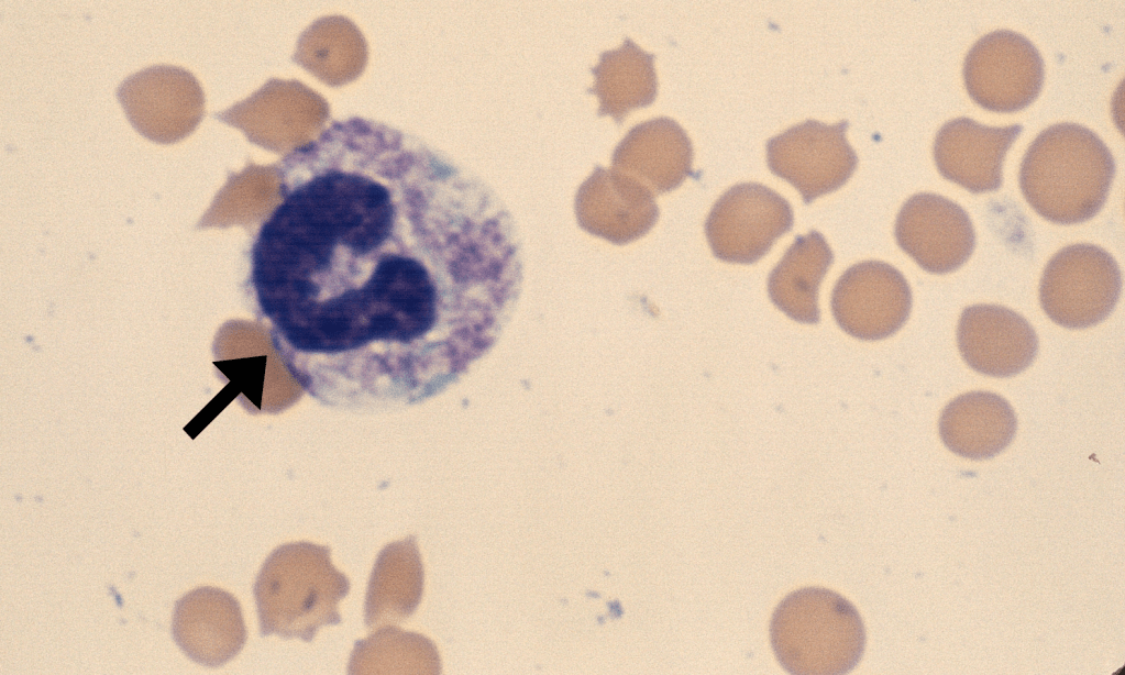 Bands (Left Shift) – Cells and Smears