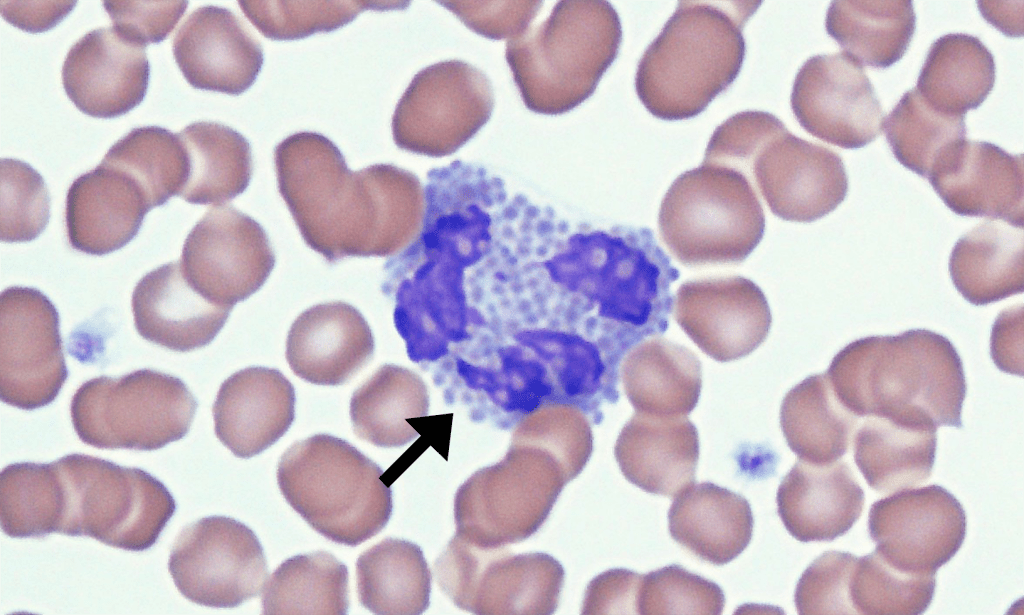 Basophils – Cells and Smears