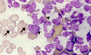Cytauxzoon felis – Cells and Smears