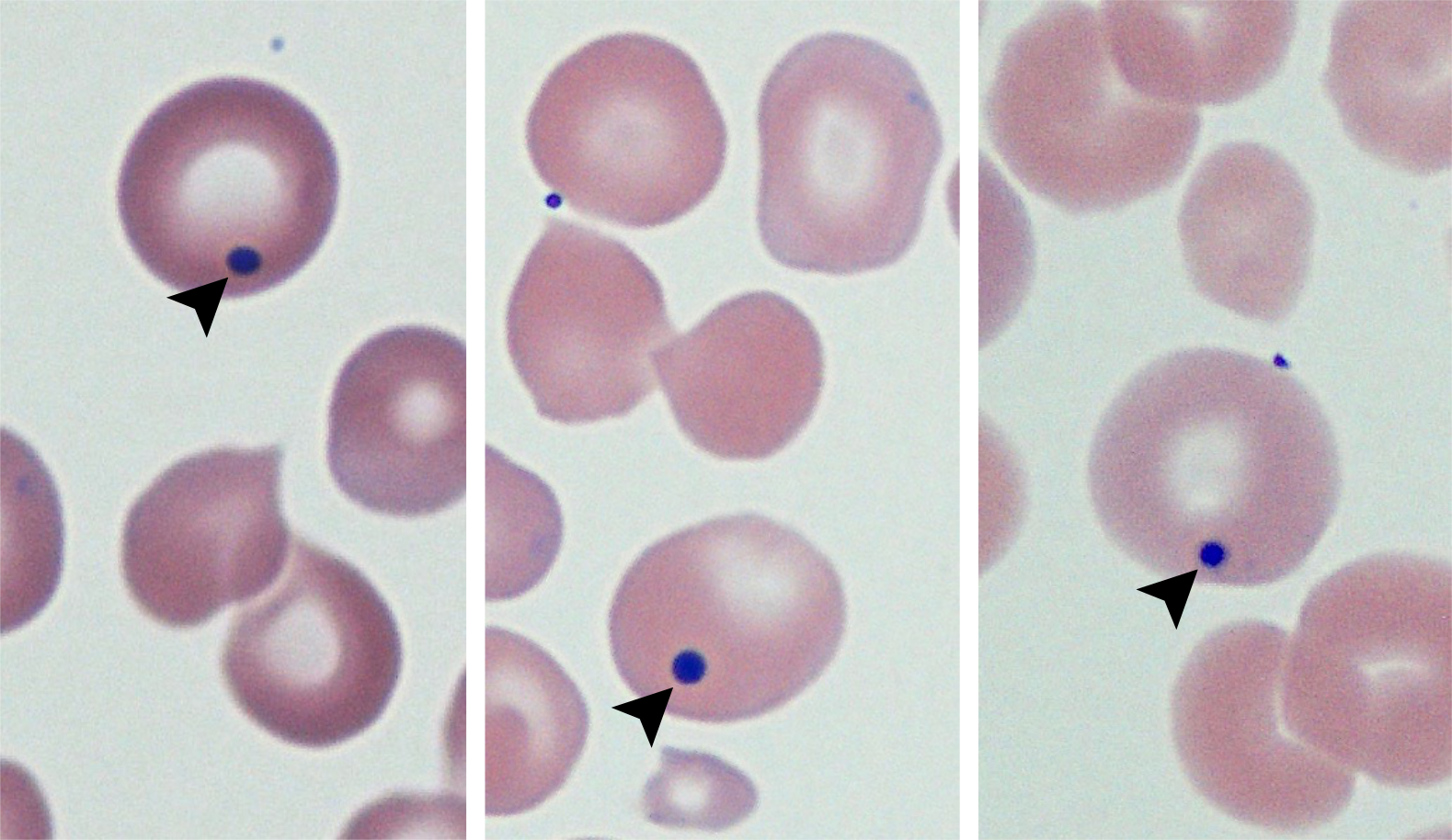 Howell Jolly Bodies Howell Jolly Bodies J Oral Med Oral Surg Oral