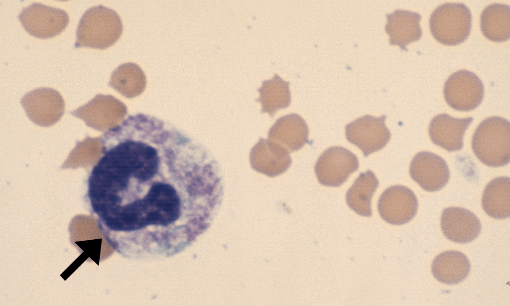 Toxic Change – Cells and Smears