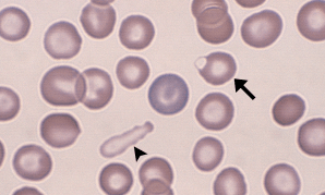 Keratocytes – Cells and Smears