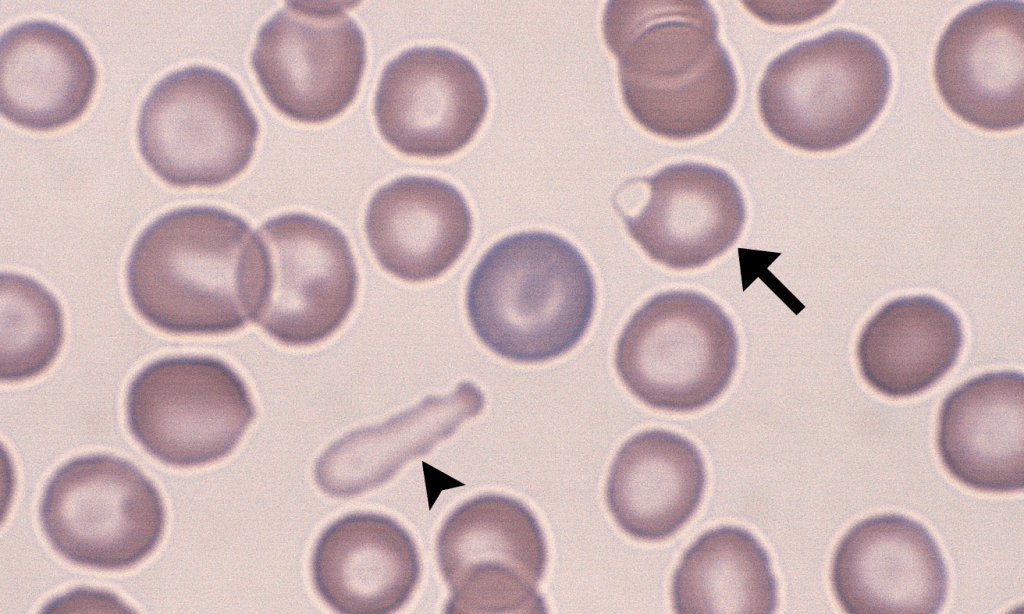 Keratocytes – Cells and Smears