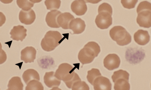 Keratocytes – Cells and Smears
