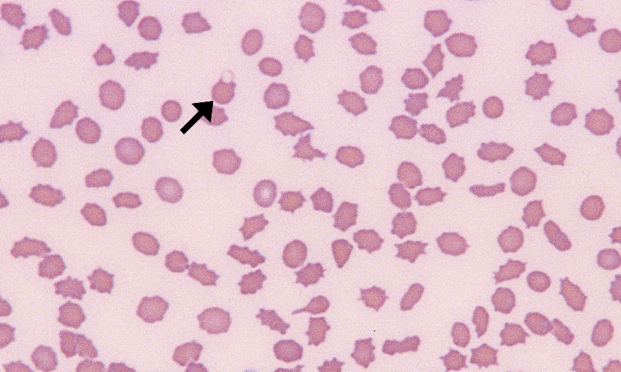 Keratocytes – Cells and Smears