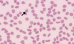 Keratocytes – Cells and Smears