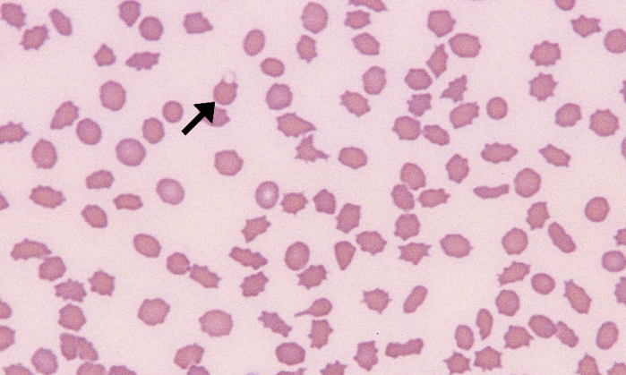 Keratocytes – Cells and Smears