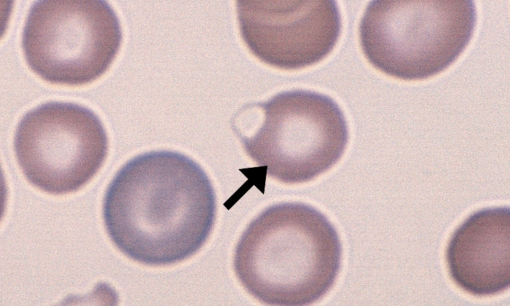 Keratocytes – Cells and Smears