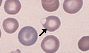 Keratocytes – Cells and Smears