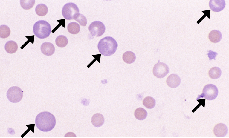 Polychromatophils – Cells and Smears