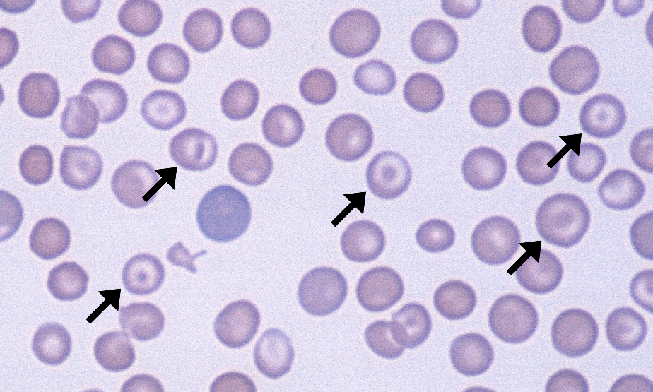 Codocytes – Cells and Smears