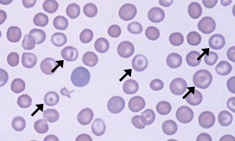 Codocytes – Cells and Smears