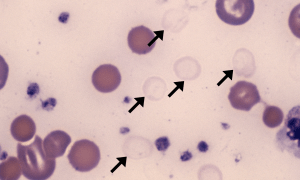 Ghost Cells – Cells and Smears