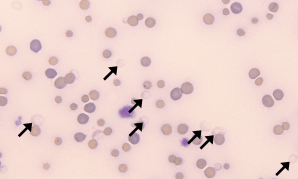 Ghost Cells – Cells and Smears