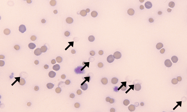 Ghost Cells – Cells and Smears