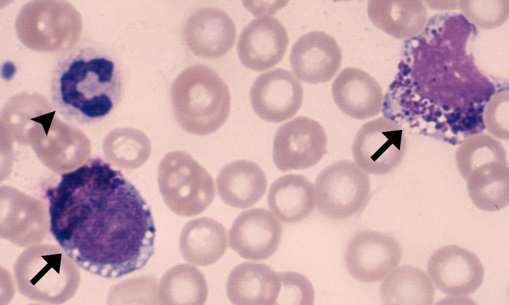Mast Cells – Cells and Smears