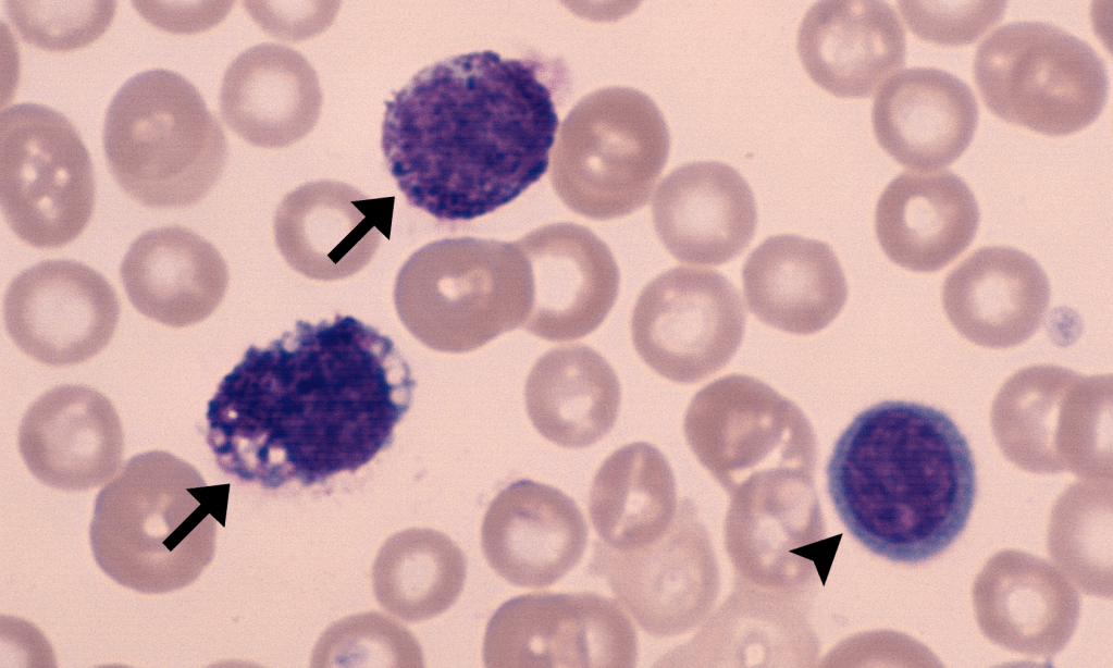 Mast Cells – Cells and Smears