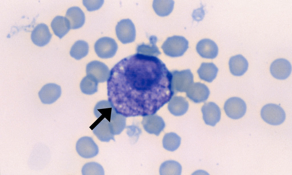 Mast Cells – Cells and Smears