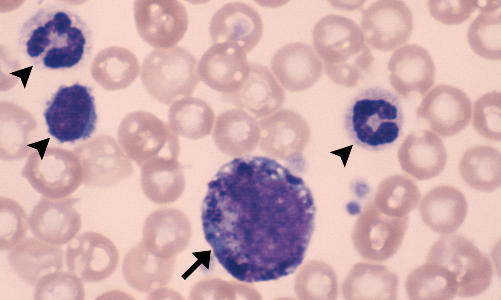Mast Cells – Cells and Smears