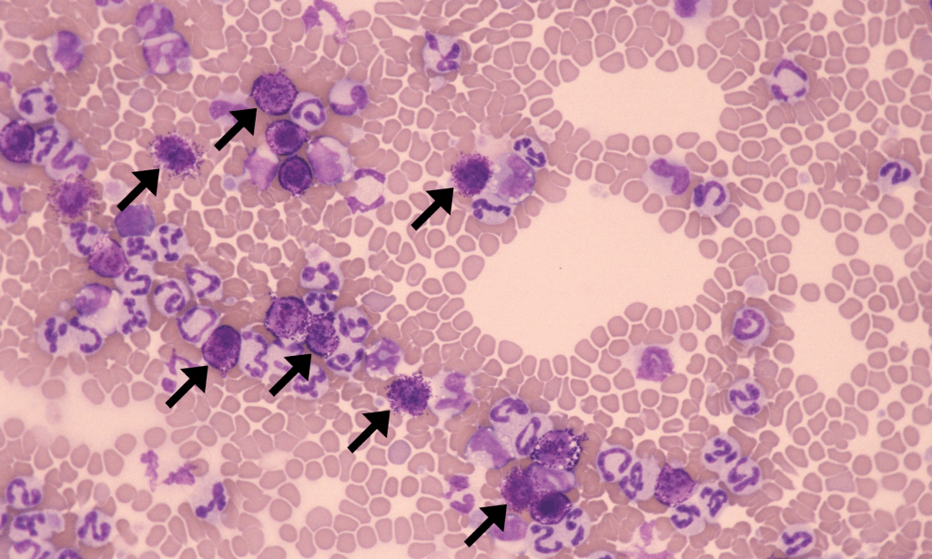 Mast Cells – Cells and Smears