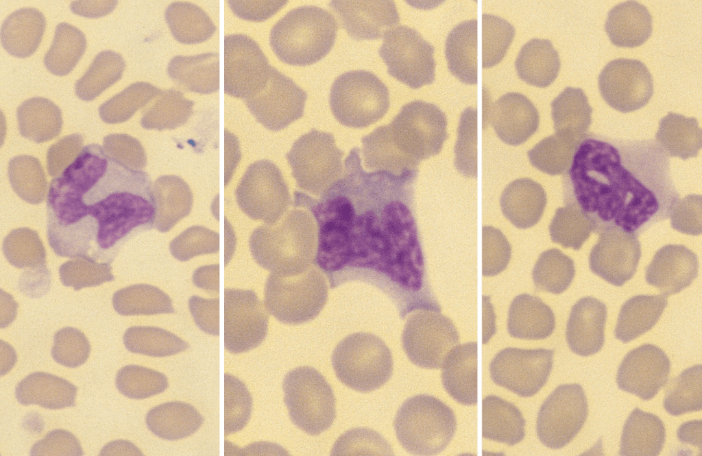 Hematology – Page 2 – Cells and Smears