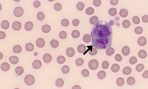 Monocytes – Cells and Smears