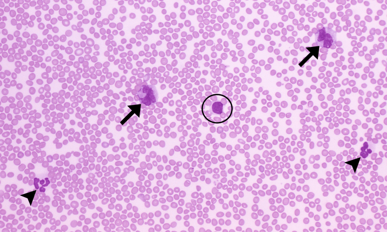 Monocytes – Cells and Smears