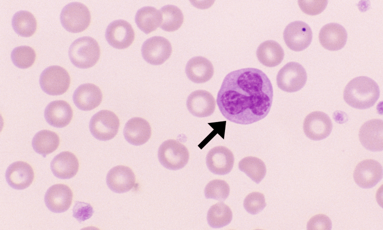 Monocytes – Cells and Smears