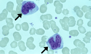 Monocytes – Cells and Smears
