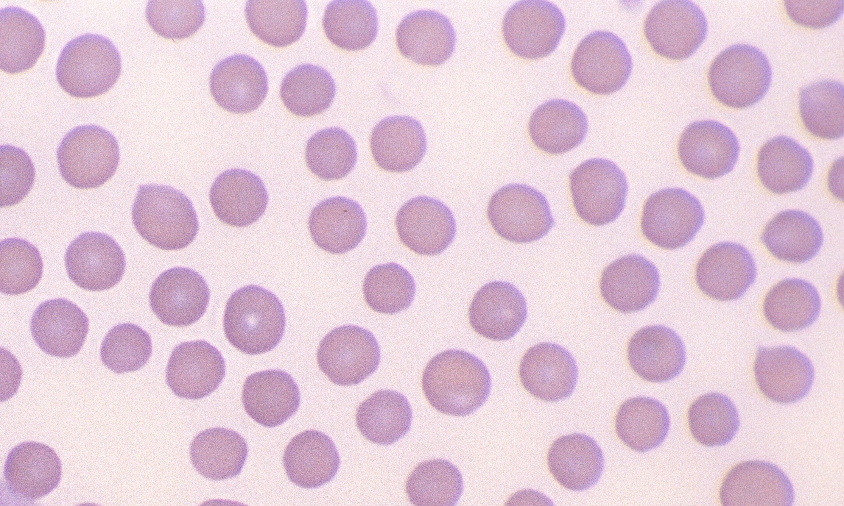 Normal – Cells and Smears