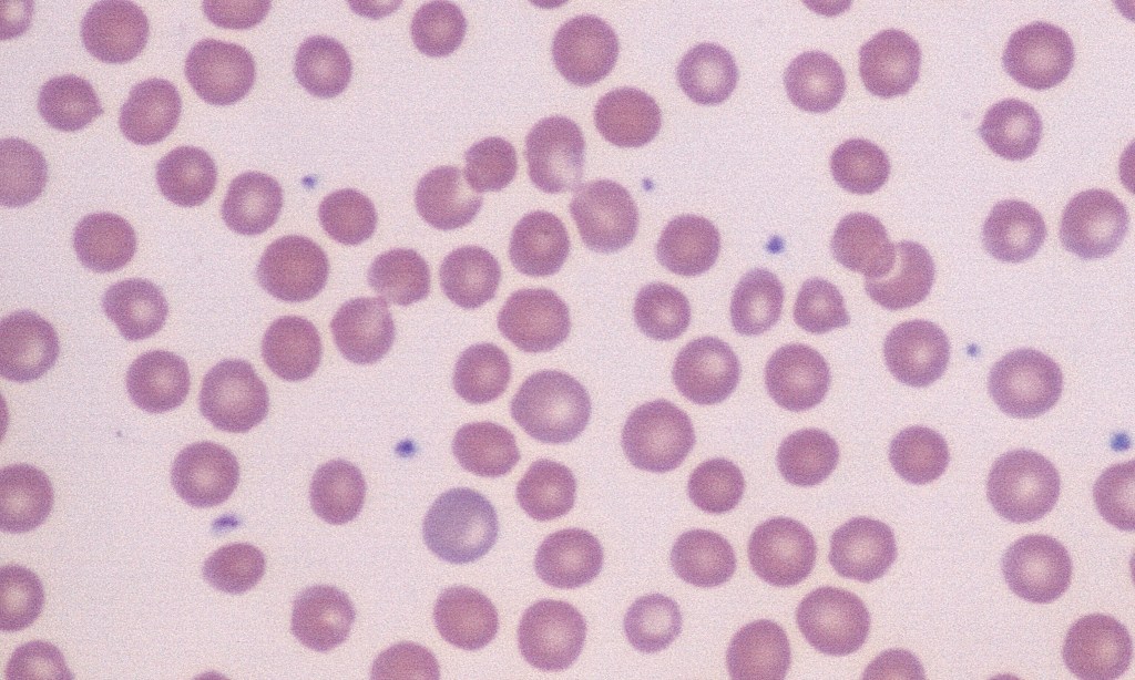 Normal Canine Erythrocytes – Cells and Smears