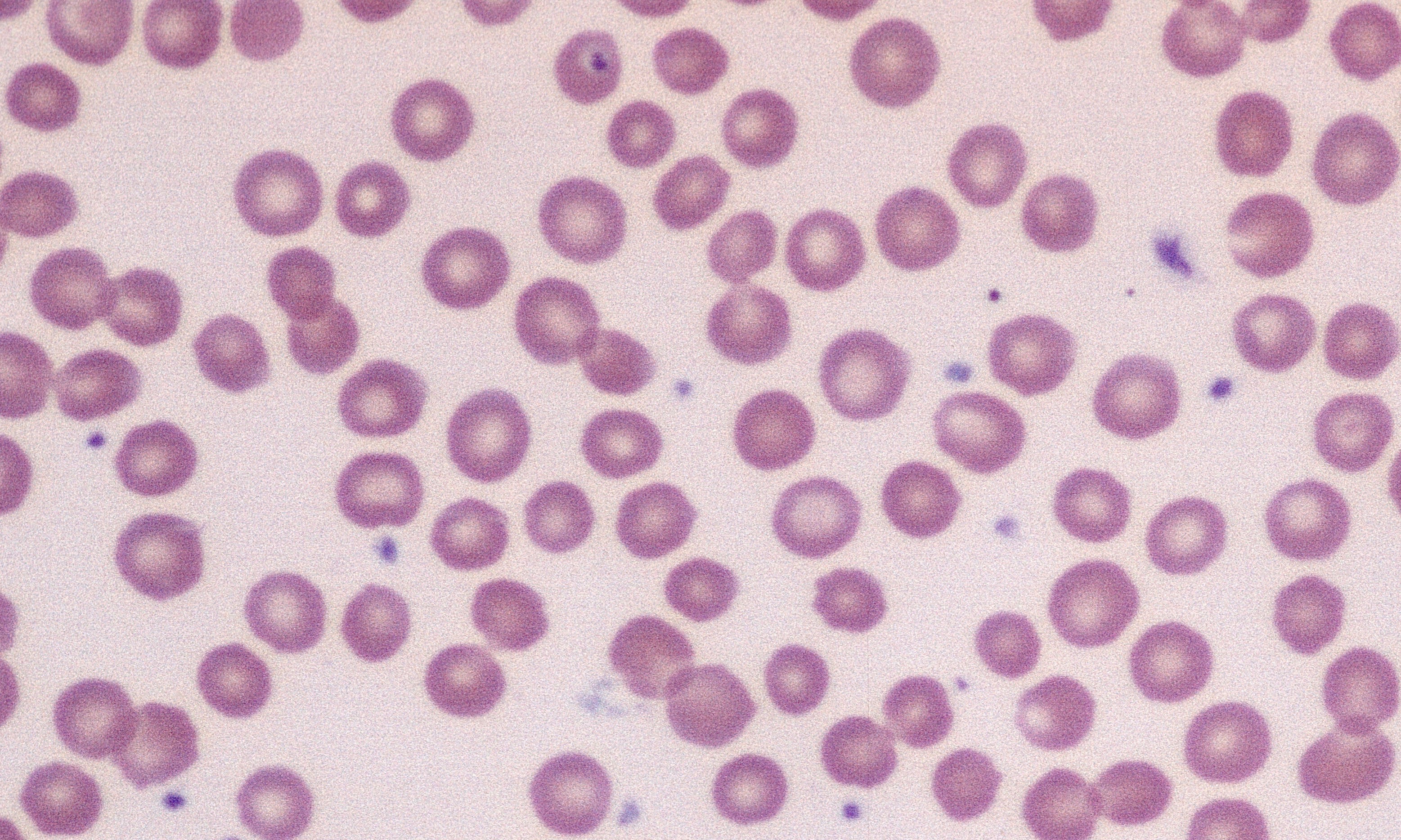 Normal Canine Erythrocytes – Cells and Smears
