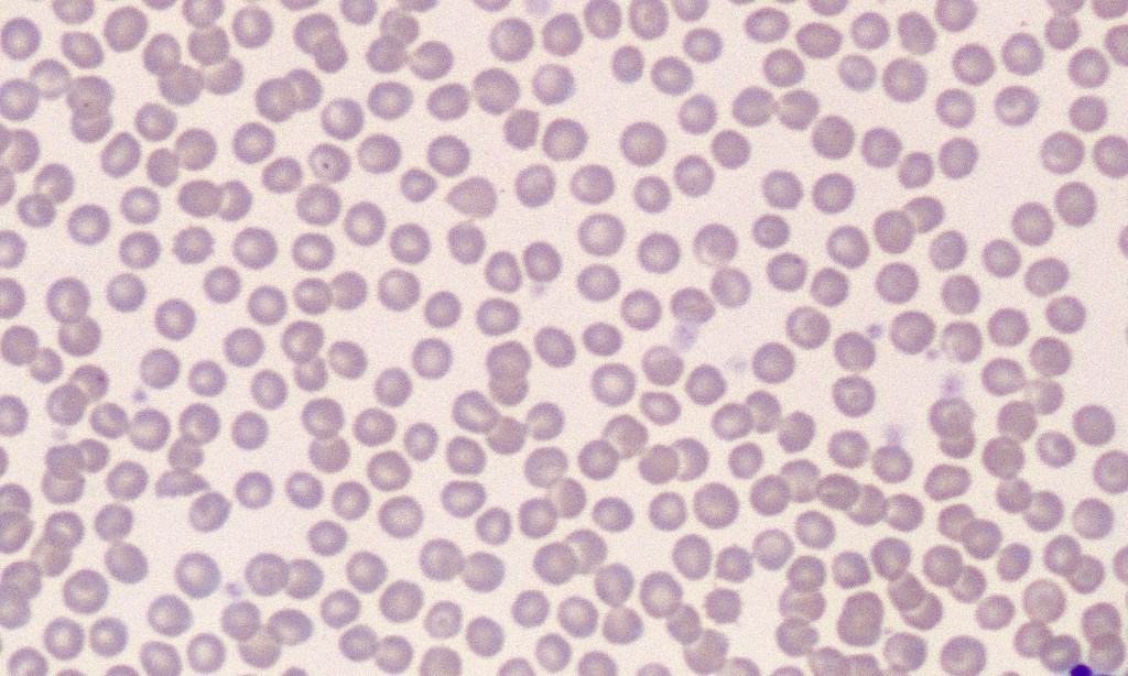 Normal Canine Erythrocytes – Cells and Smears