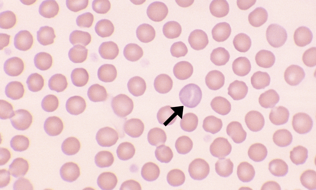 Normal Canine Erythrocytes – Cells and Smears