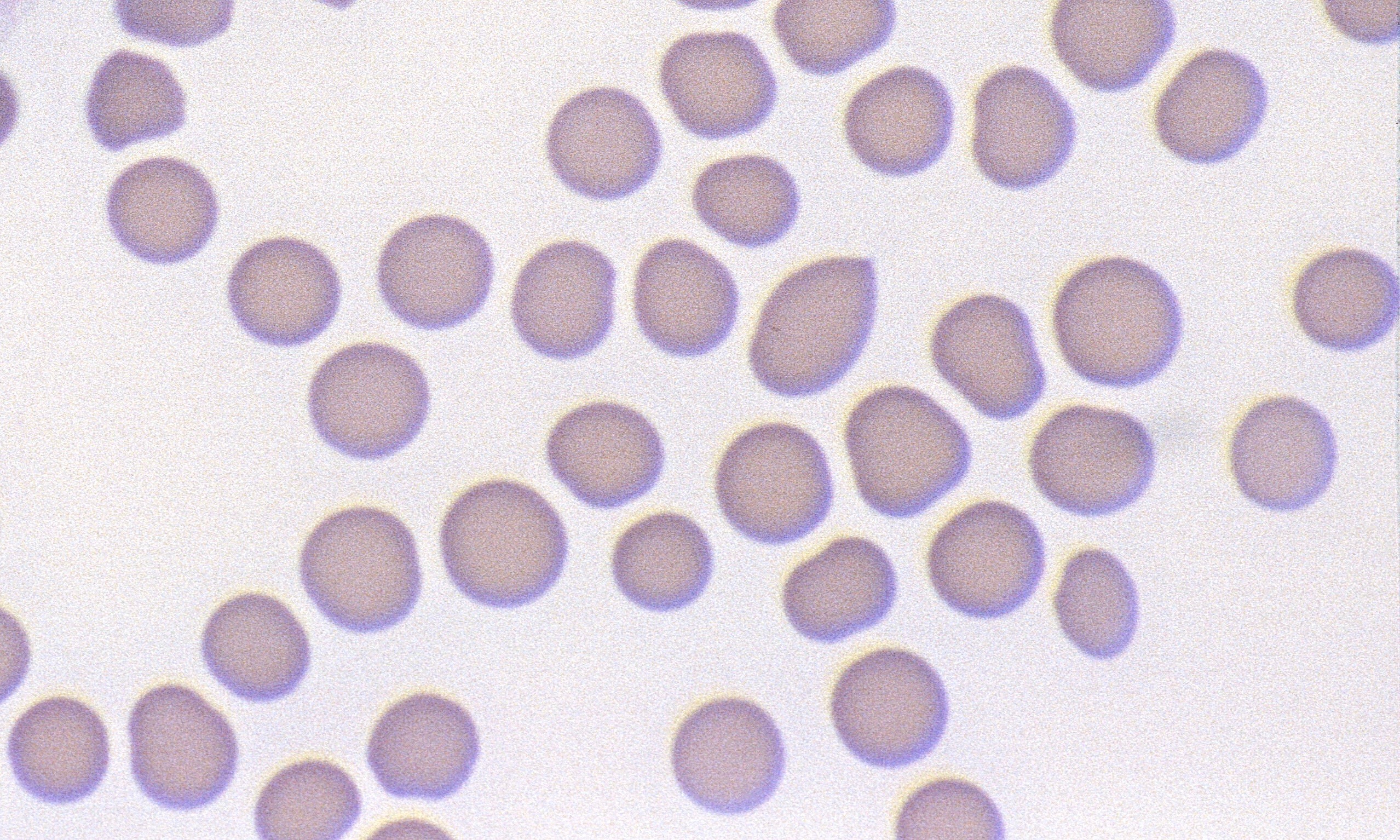 Normal – Cells and Smears