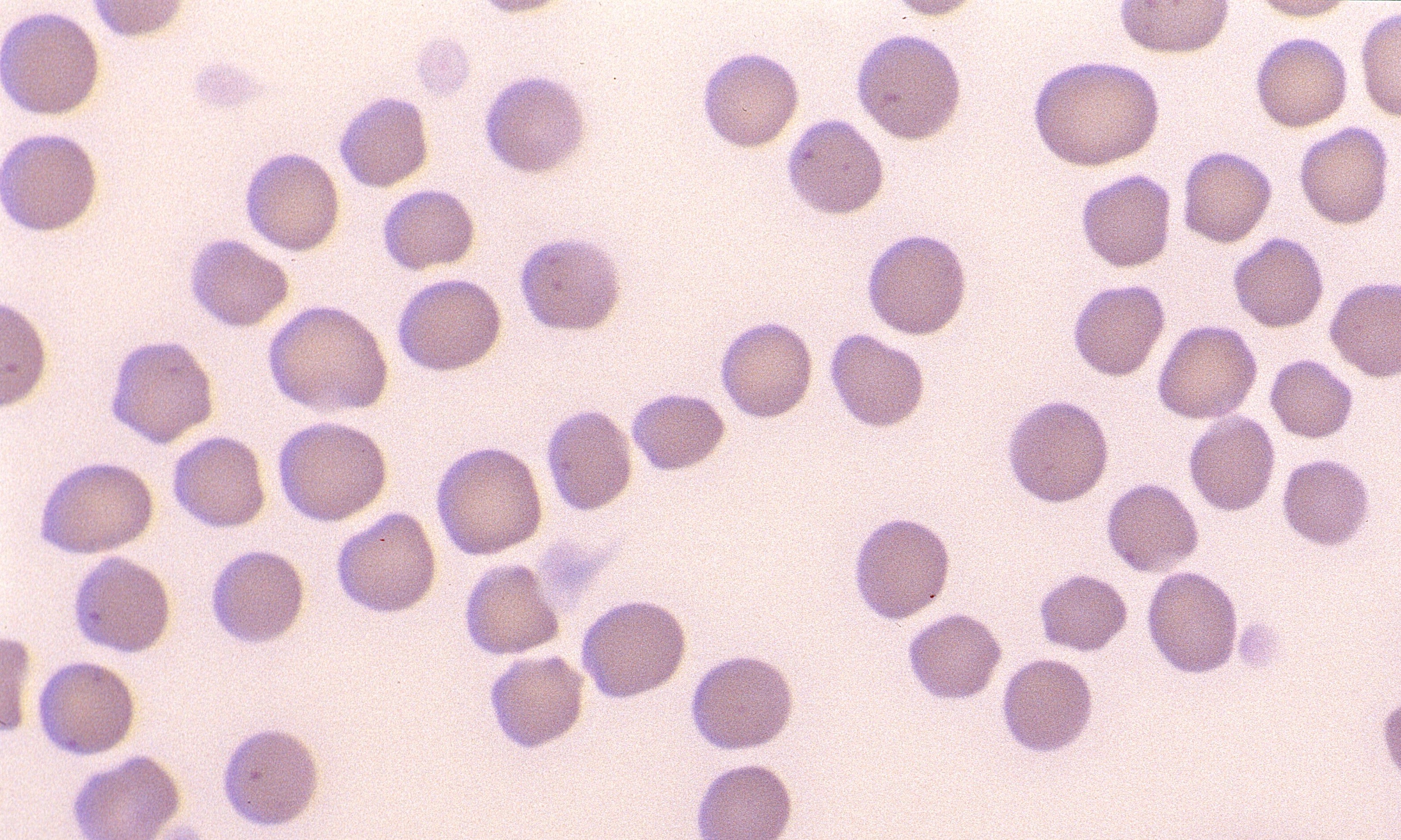 Normal Equine Erythrocytes – Cells and Smears