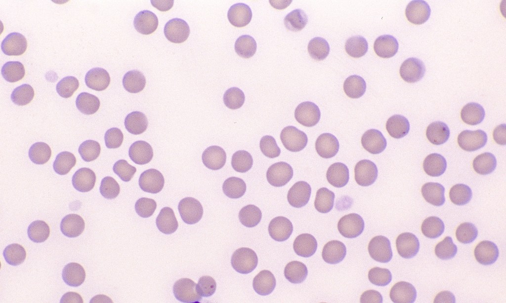 Normal Equine Erythrocytes – Cells and Smears