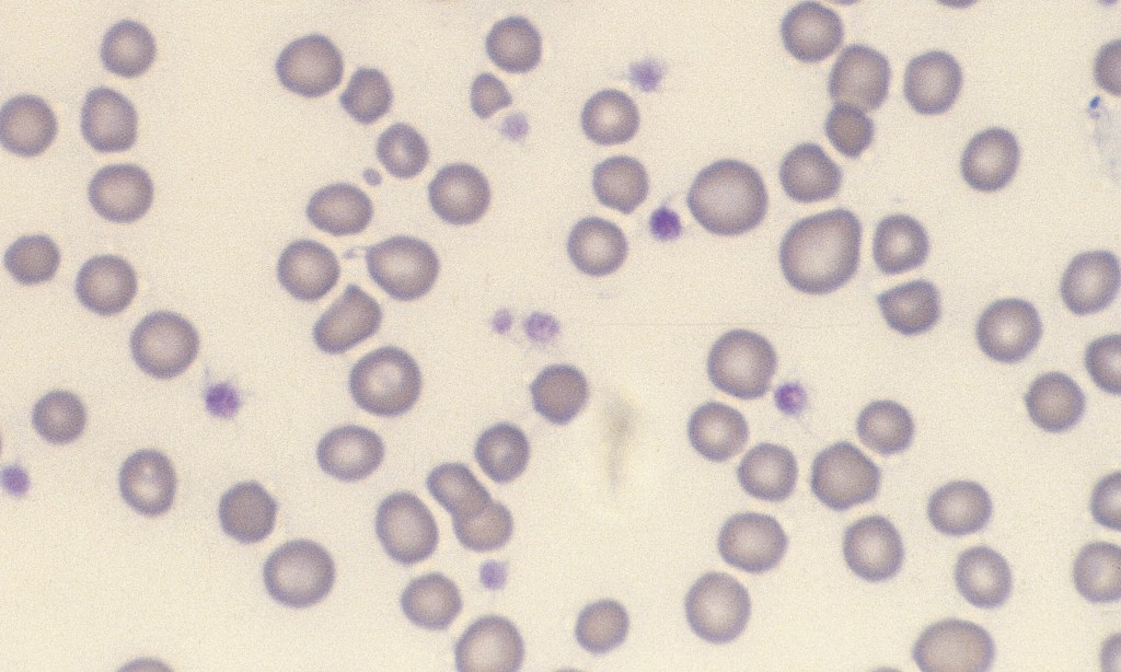 Normal Feline Erythrocytes – Cells and Smears