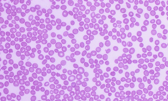 Normal – Cells and Smears