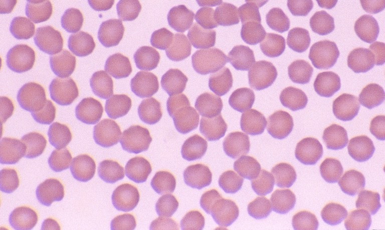 Normal Sheep Erythrocytes – Cells and Smears