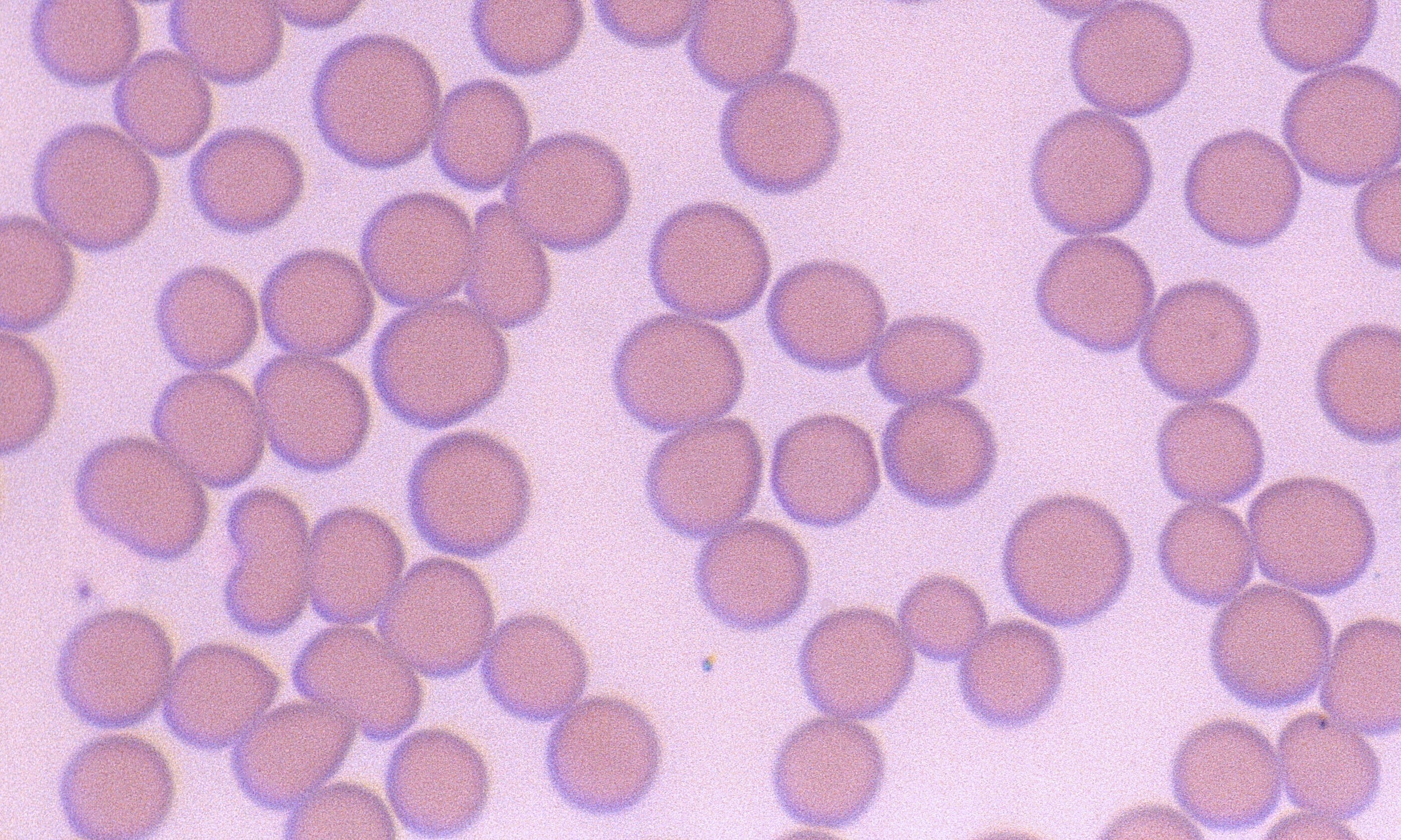 Normal Sheep Erythrocytes – Cells and Smears