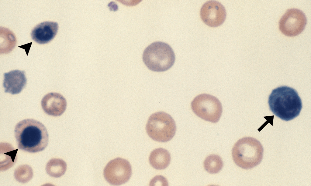 Nucleated Red Blood Cells – Cells and Smears